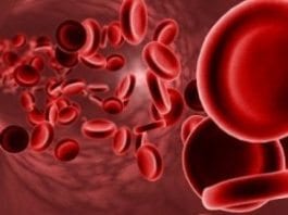 What is anemia? What are its symptoms? - Indigo Magazine