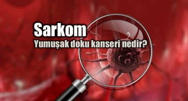 Sarkom: Symptomer og behandling af bløddelskræft