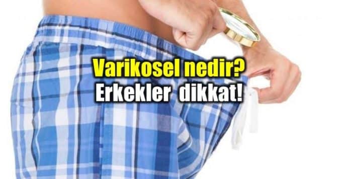 Varikosel nedir? Erkeklerde kısırlık en önemli sebebi