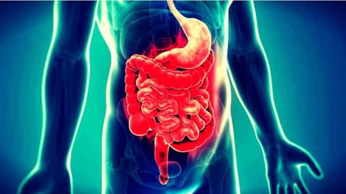 Ülseratif Kolit nedir? İnflamatuar bağırsak ve Crohn hastalığı belirtileri