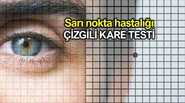 Sarı nokta hastalığı için Amsler Grid (Çizgili Kare) Testi