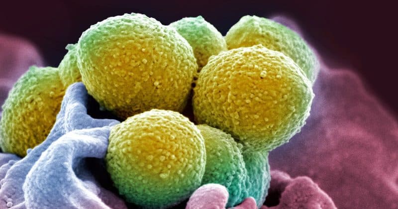 Strep A: Yeni bir salgınla mı karşı karşıyayız?