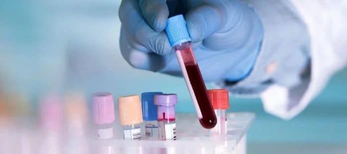 HPV testi nasıl yapılır? HPV aşısı hakkında merak edilenler