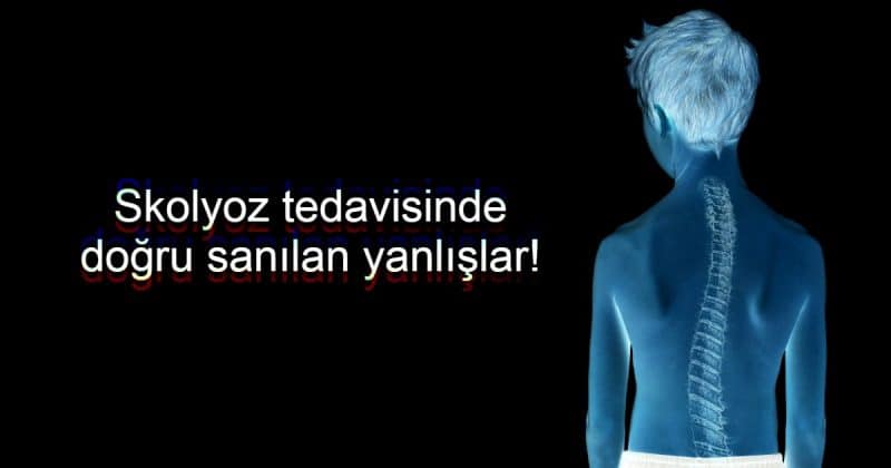 Skolyoz tedavisinde doğru sanılan 7 yanlış! - İndigo Dergisi