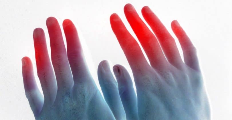 Cos'è la malattia di Raynaud? Quali sono i suoi sintomi? - Indigo Magazine